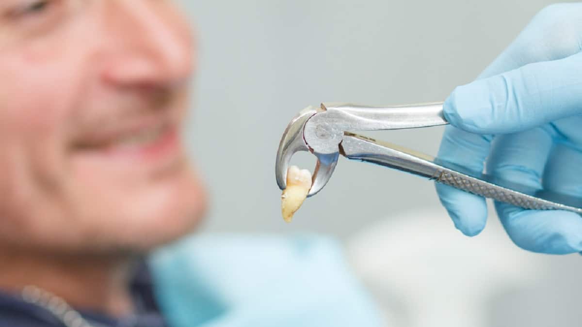 Cabut Gigi dan Prosedurnya yang Perlu Kamu Ketahui | Good Doctor | Tips Kesehatan, Chat Dokter ...